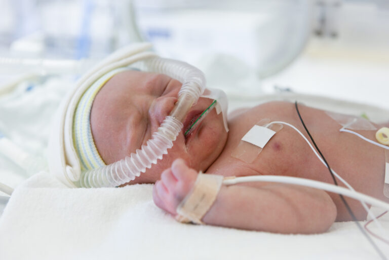 Neonatal Lung Maturity Test Archives - SIME Clinical AI